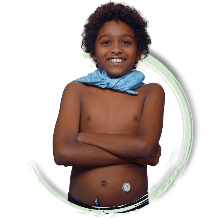 LinX CGM - The Smallest Continuous Glucose Monitor | Accurate Real-Tim ...